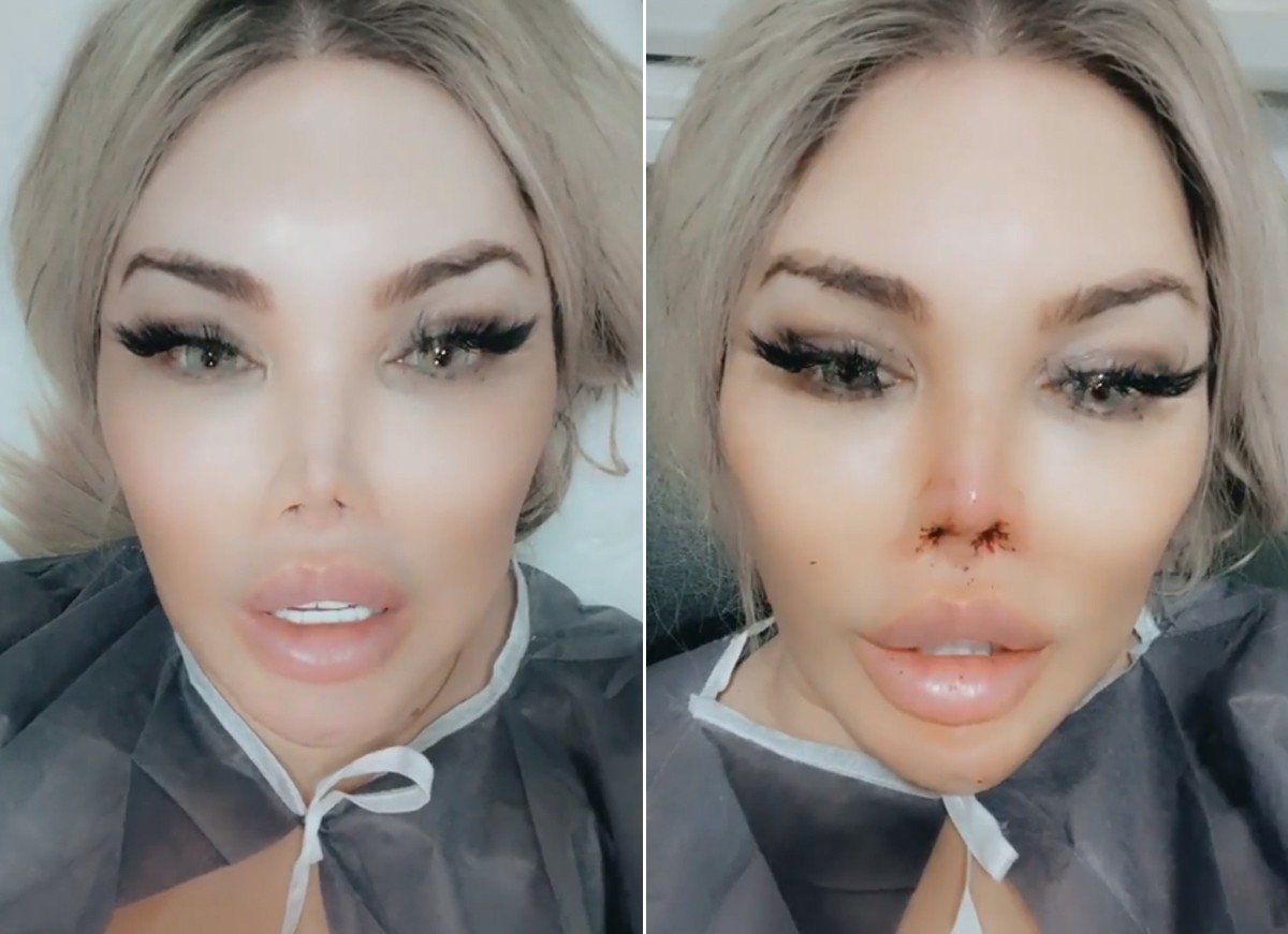 Jéssica Alves é Chamada De Monstro Por Médico E Fica Furiosa Ao Vivo